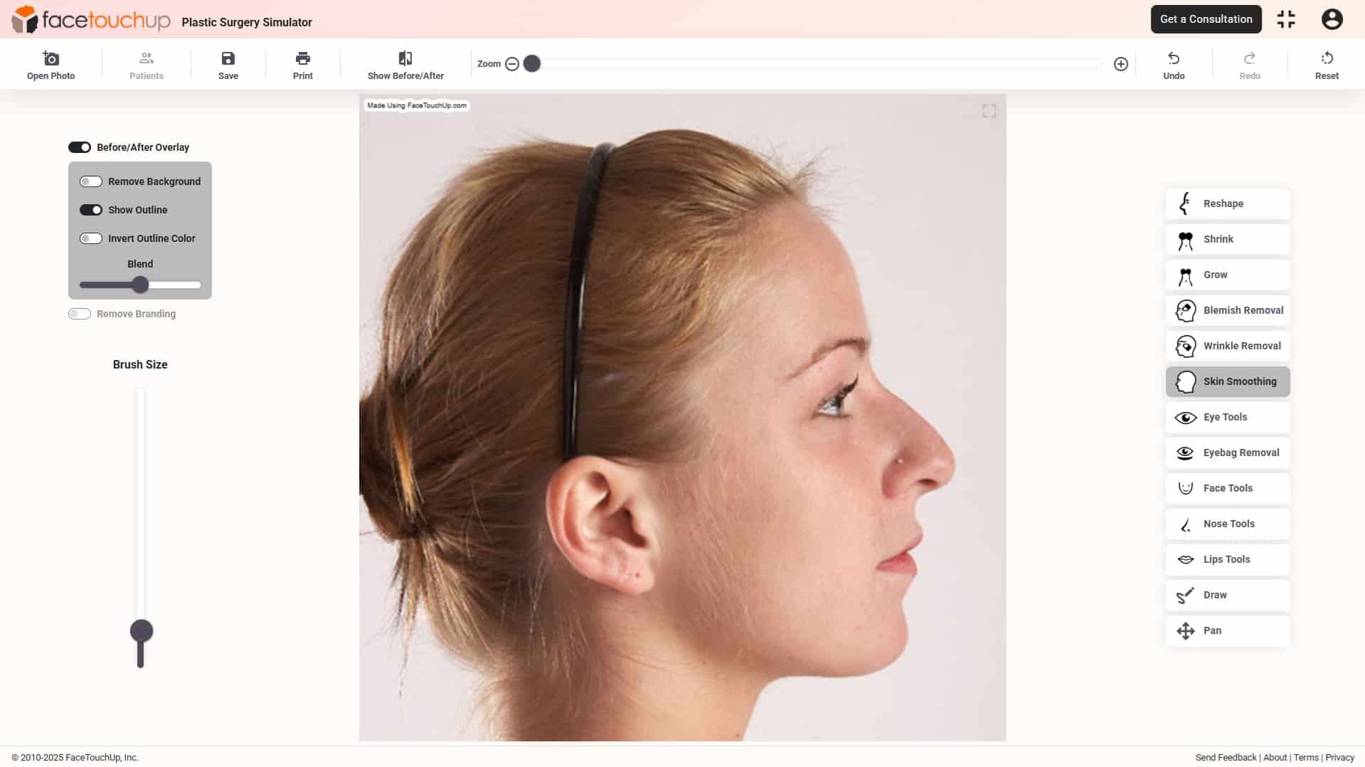 Free Nose Imaging for Rhinoplasty Surgery - Melbourne ENT