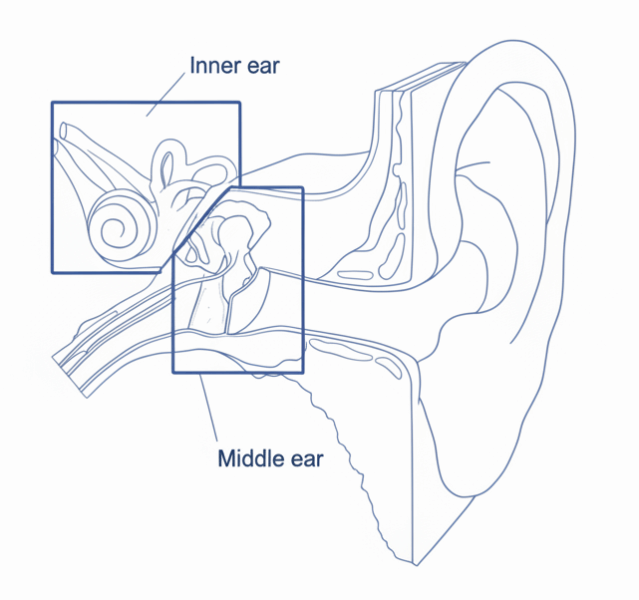Grommet Surgery Melbourne | Melbourne ENT Dr Simon Braham