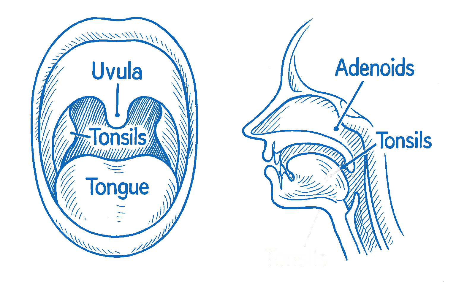 Tonsillectomy Melbourne | Adult & Child ENT Surgery